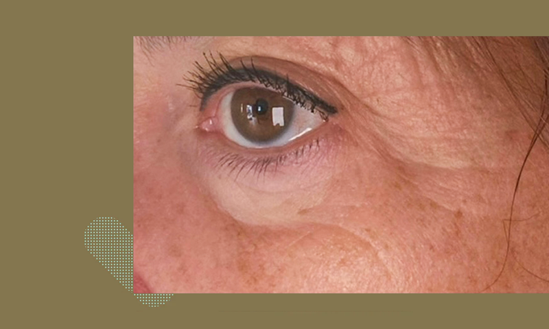 RD Cosmetic l Soins Anti-Âge au Collagène et Élastine